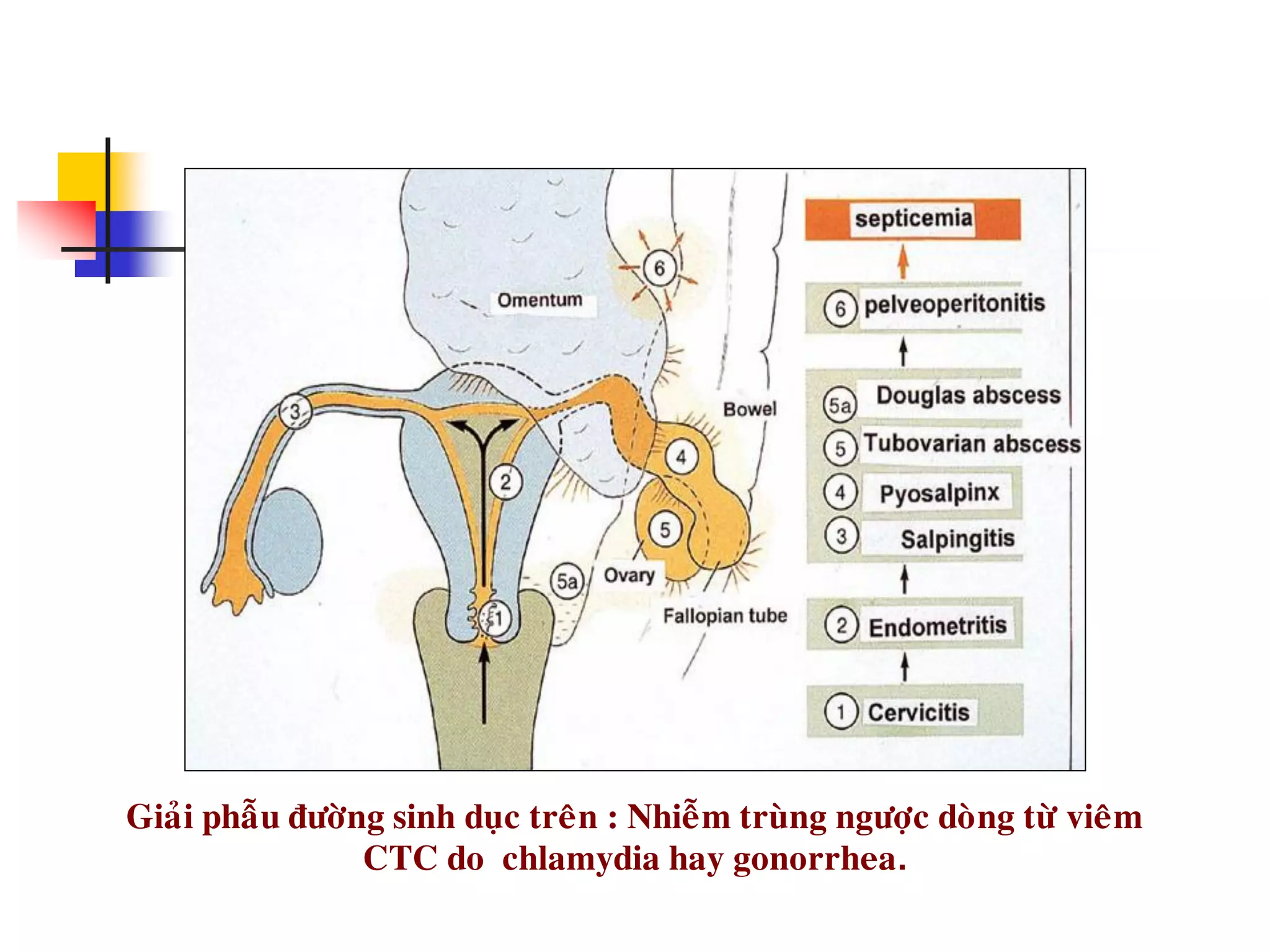 VIÊM SINH DỤC VÀ CÁC BỆNH LÂY LAN QUA ĐƯỜNG SINH DỤC | PDF