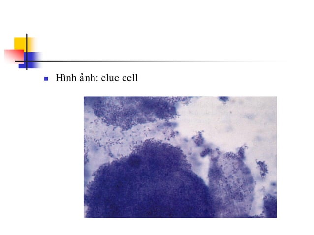 VIÊM SINH DỤC VÀ CÁC BỆNH LÂY LAN QUA ĐƯỜNG SINH DỤC | PDF