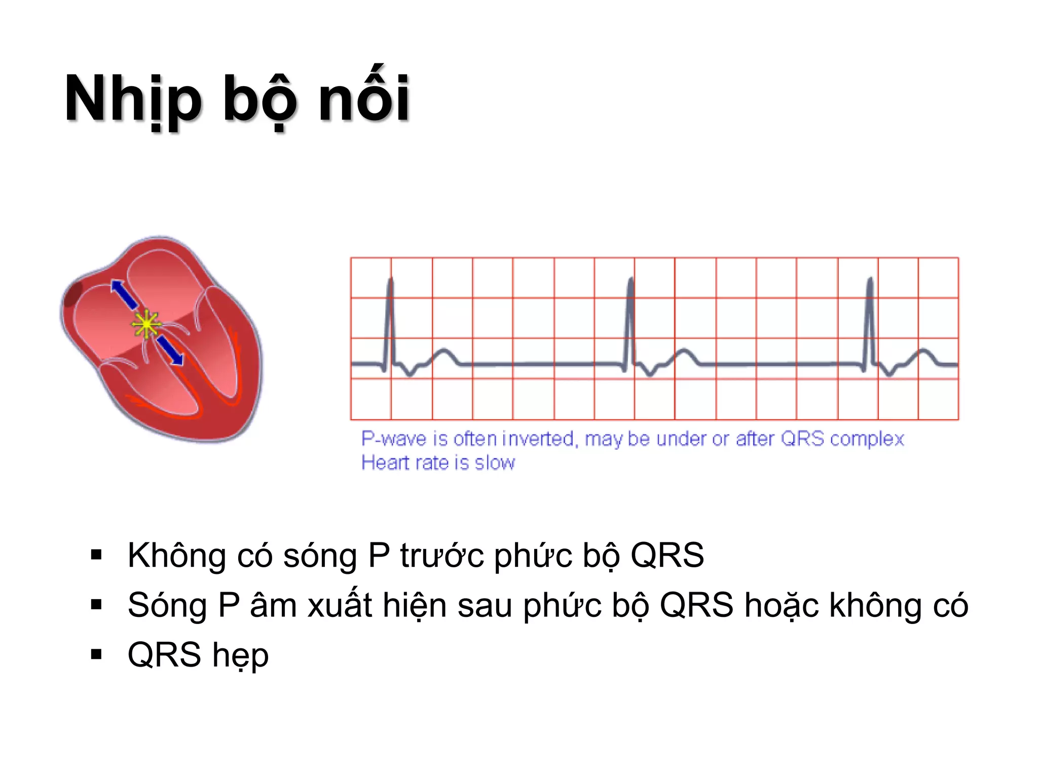 CÁC DẠNG NHỊP TRONG ECG | PDF
