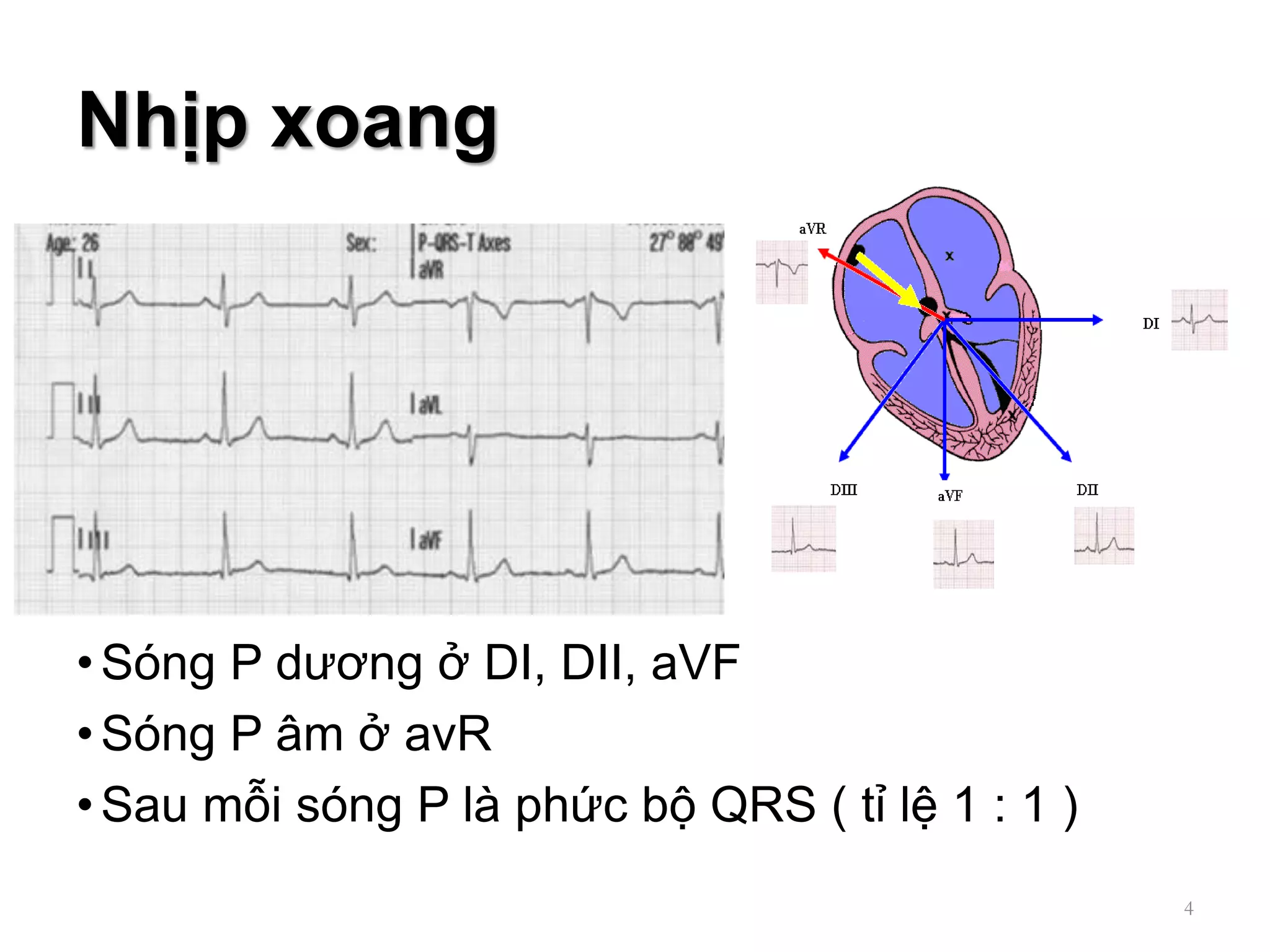 CÁC DẠNG NHỊP TRONG ECG | PDF
