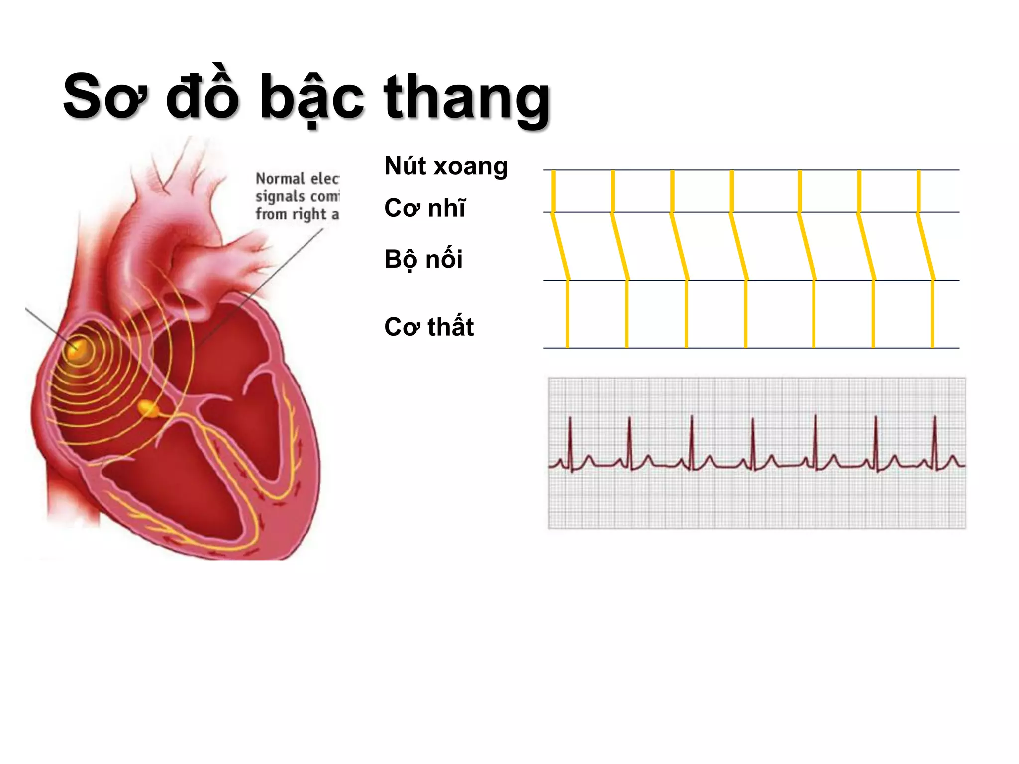 CÁC DẠNG NHỊP TRONG ECG | PDF