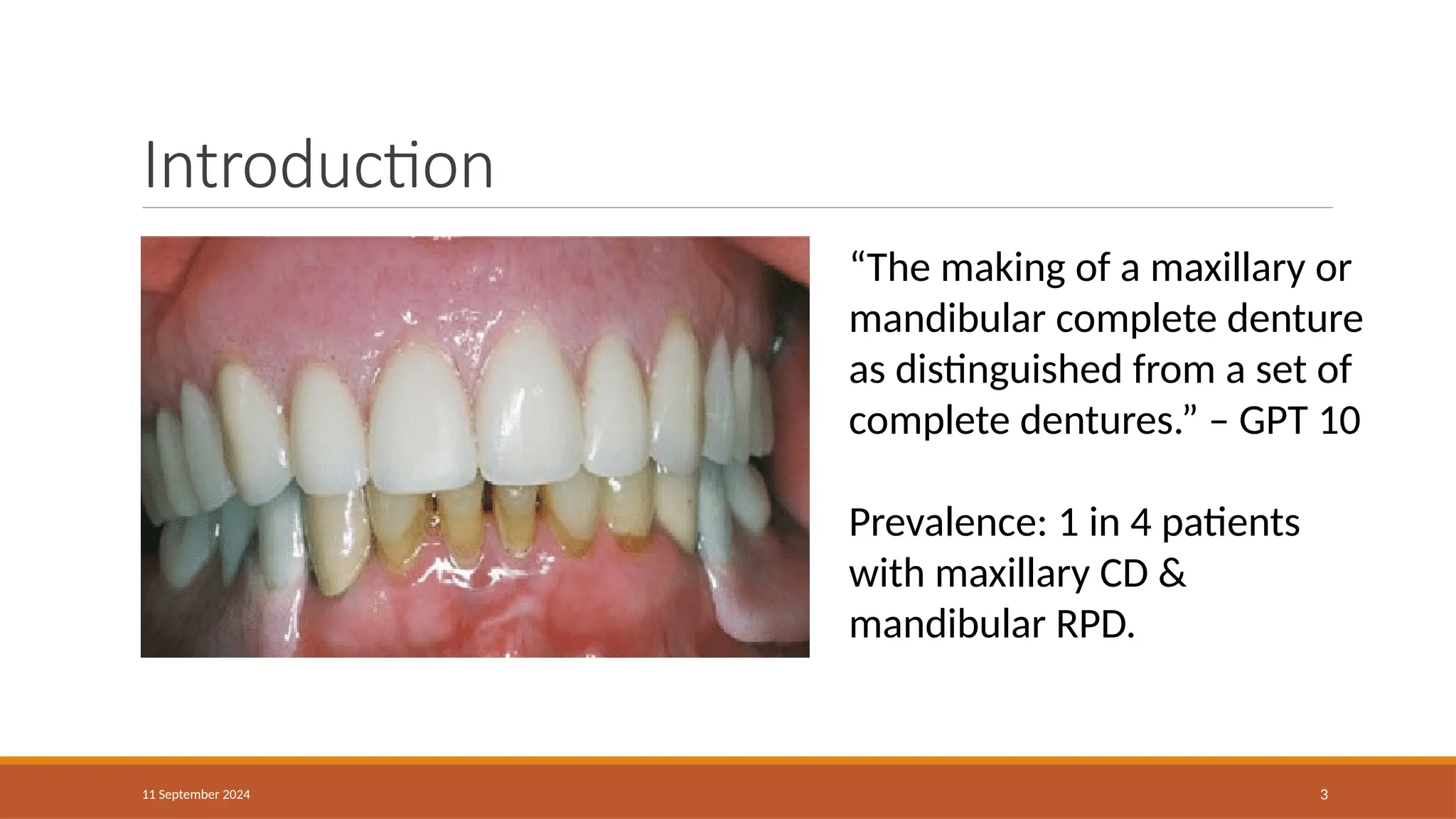 Kelly's combination syndrome and its management | PPTX