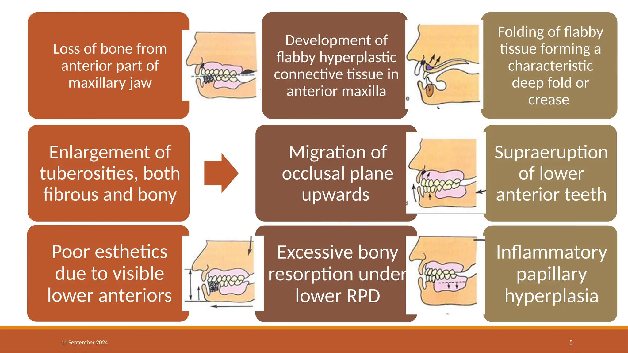 Kelly's combination syndrome and its management | PPTX