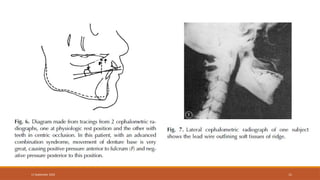 Kelly's combination syndrome and its management | PPTX