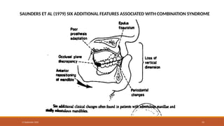 Kelly's combination syndrome and its management | PPTX