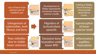 Kelly's combination syndrome and its management | PPTX