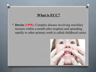 prevalance of early childhood caries and asssociation with feeding ...