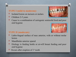 prevalance of early childhood caries and asssociation with feeding ...