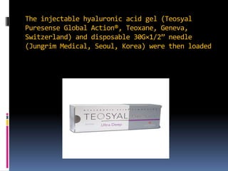 To evaluate the clinical efficacy of enhancing deficient interdental ...