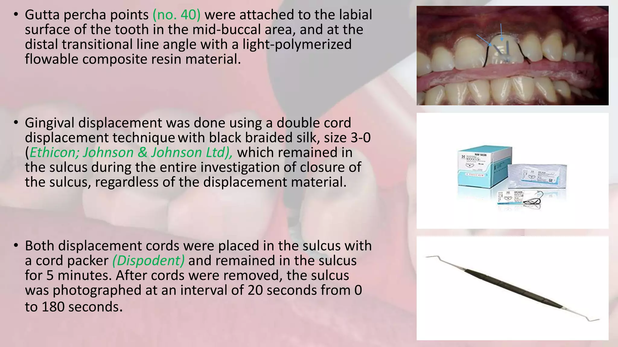 gingival retraction methods | PPTX