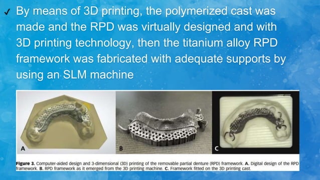 Prosthodontics Journal Club: Altered cast impression techniques | PPTX