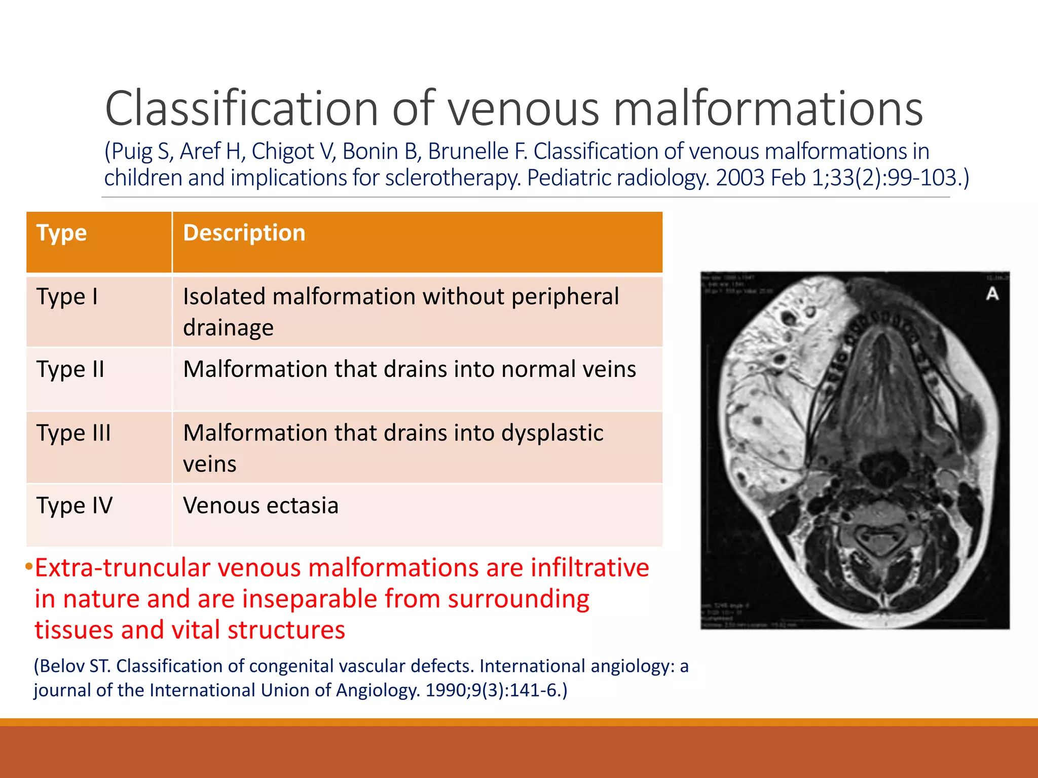 Corseting: A new technique for the management of diffuse venous ...