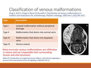 Corseting: A new technique for the management of diffuse venous ...