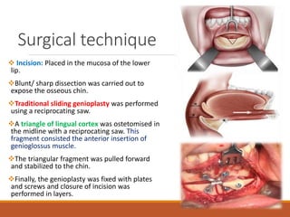 Genioglossus muscle advancement and simultaneous sliding genioplasty in ...