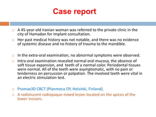 Jc 1 cbct findings of periapical cemento-osseous dysplasia | PPTX