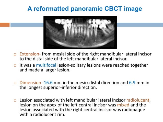 Jc 1 cbct findings of periapical cemento-osseous dysplasia | PPTX