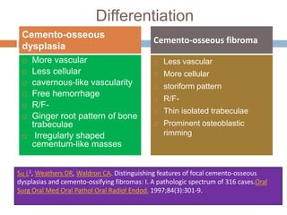 Jc 1 cbct findings of periapical cemento-osseous dysplasia | PPTX