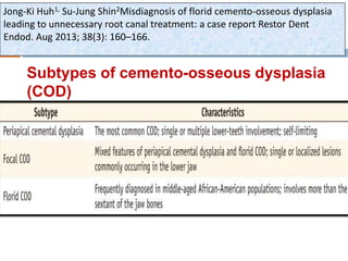 Jc 1 cbct findings of periapical cemento-osseous dysplasia | PPTX