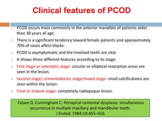 Jc 1 cbct findings of periapical cemento-osseous dysplasia | PPTX