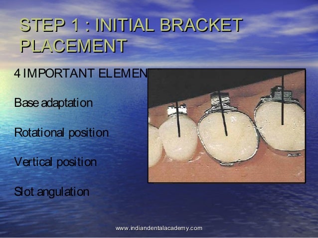 bracket positioning in orthodontics / dental crown & bridge courses