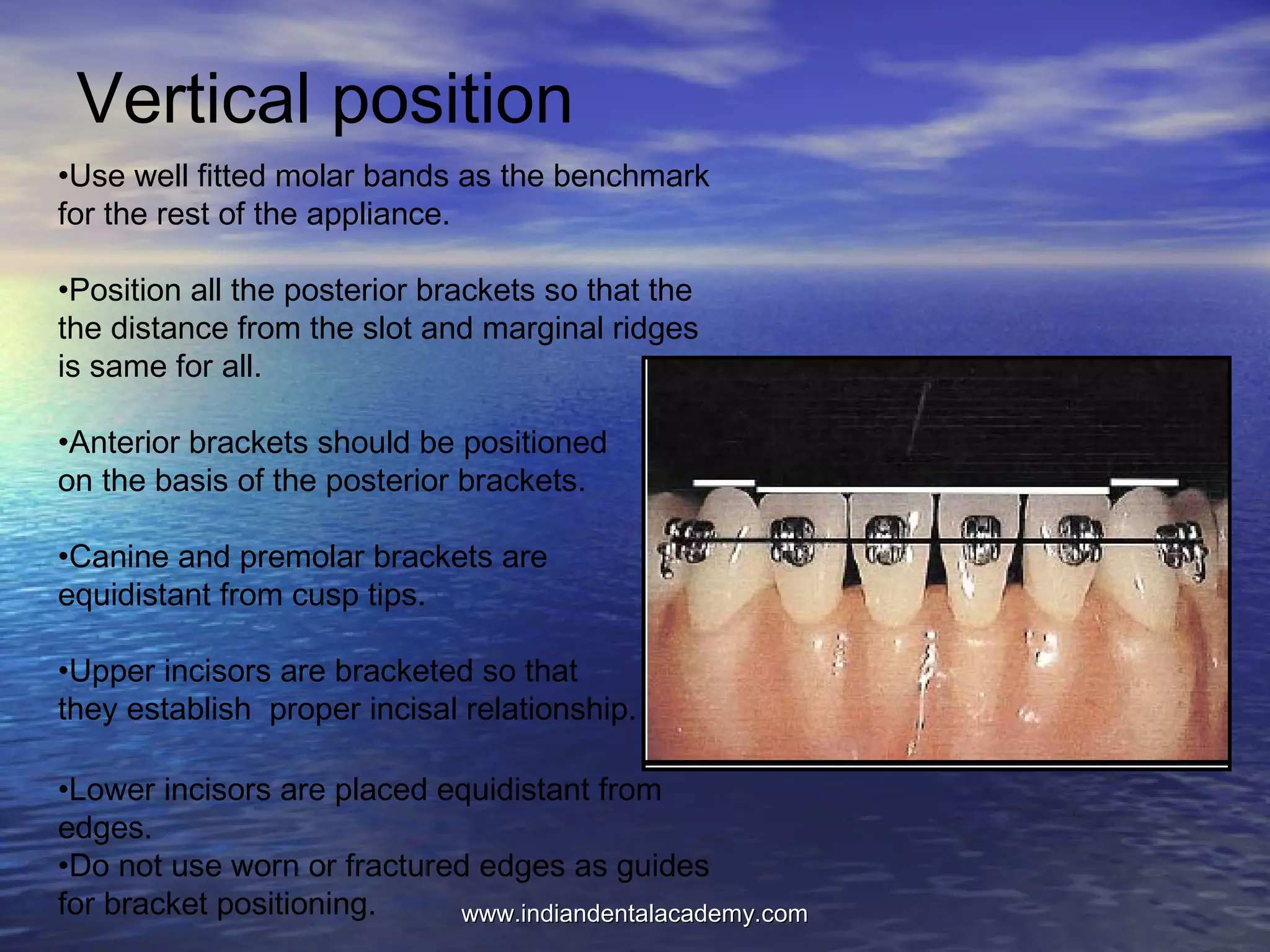 bracket positioning and resets/ cosmetic dentistry courses | PPT ...