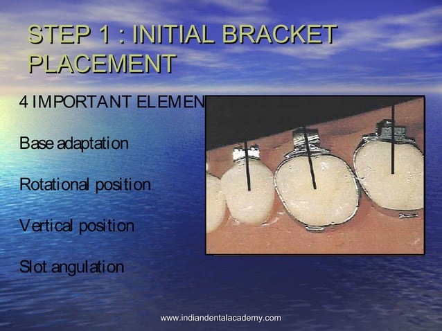 bracket positioning and resets/ cosmetic dentistry courses | PPT ...
