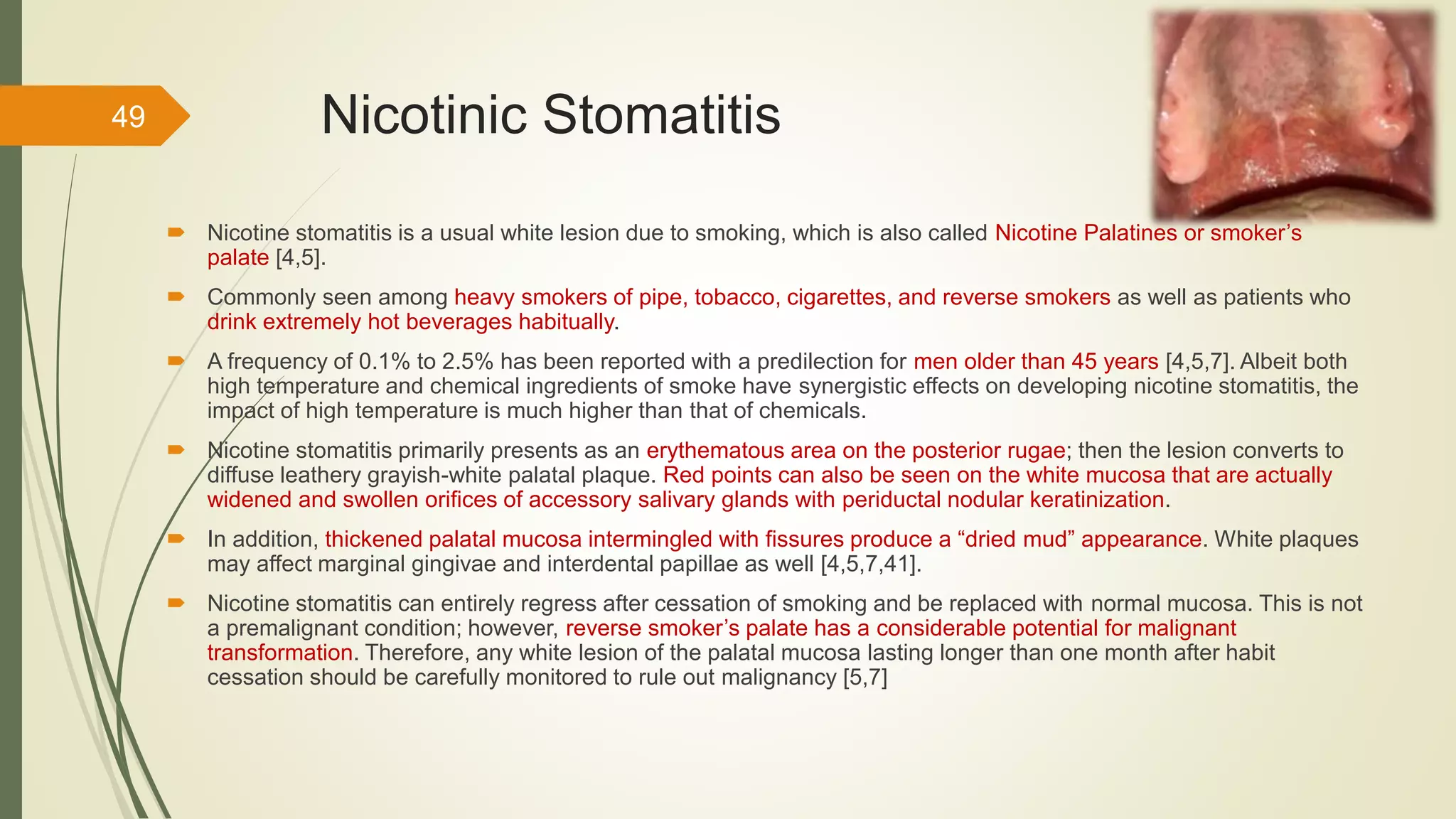 D/D of white lesions- journal club