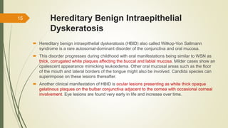 D/D of white lesions- journal club | PPTX