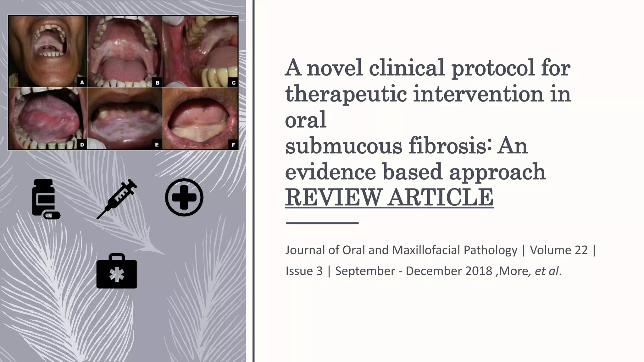 OSMF treatment of various stages- Journal Club | PPTX