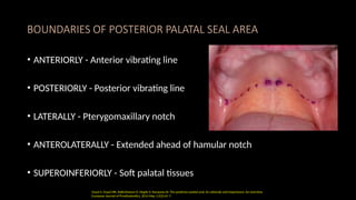 Soft palate relations with junction of soft and hard palate | PPTX