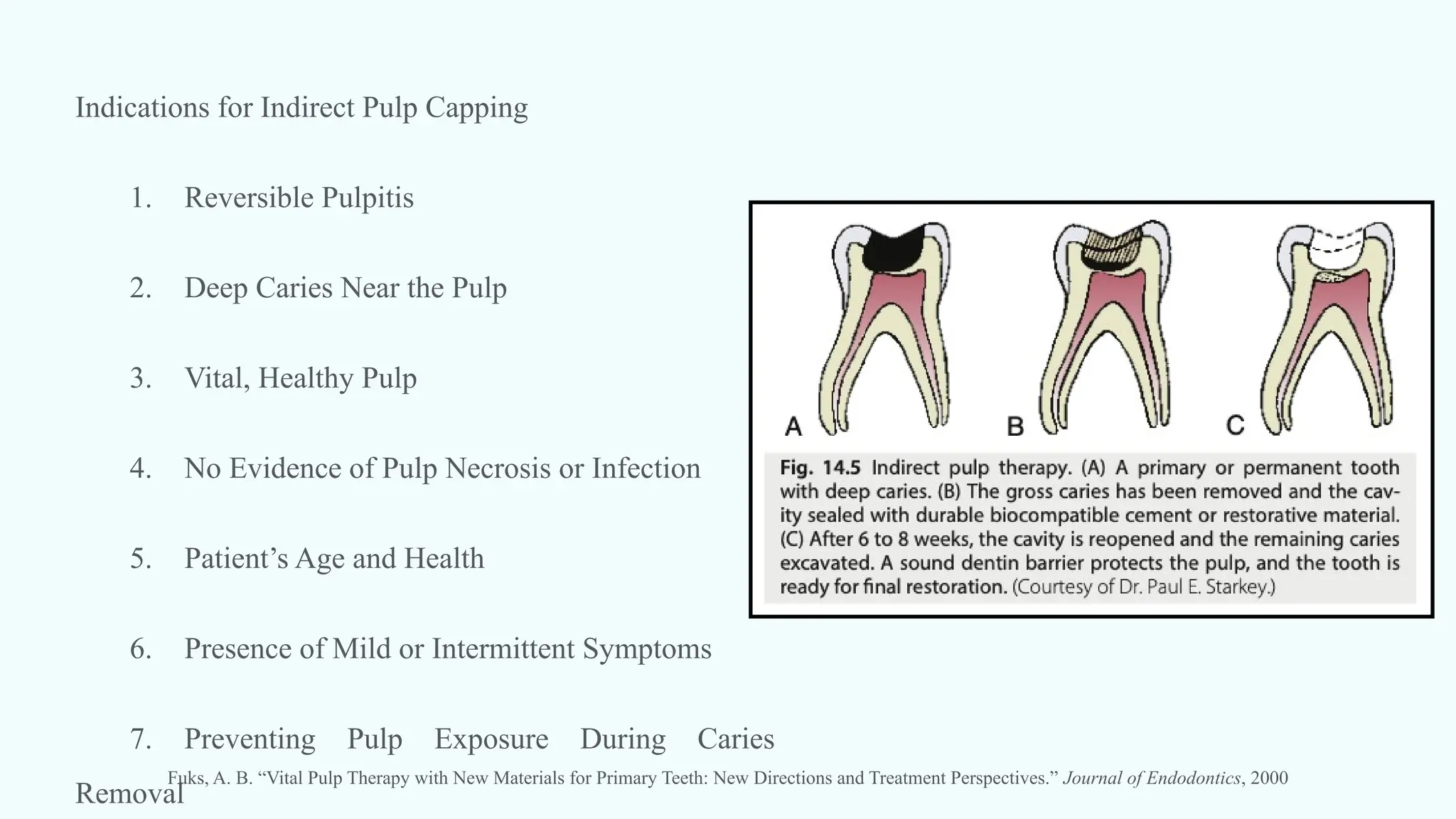 Success Rate of Antibiotic Sterilization, Indirect Pulp Treatment, and ...