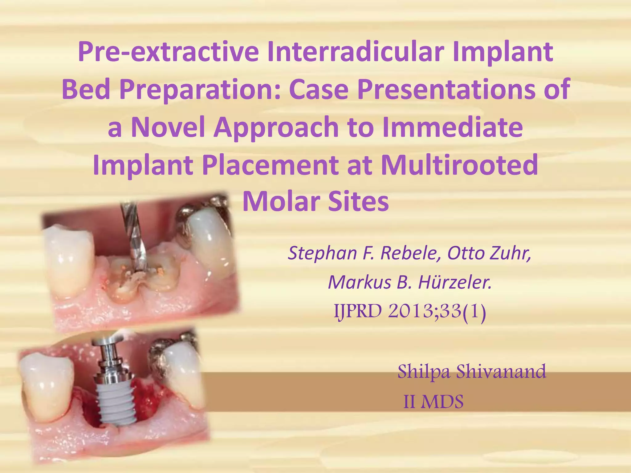 Journal Club On Pre-extractive Interradicular Implant Bed Preparation ...