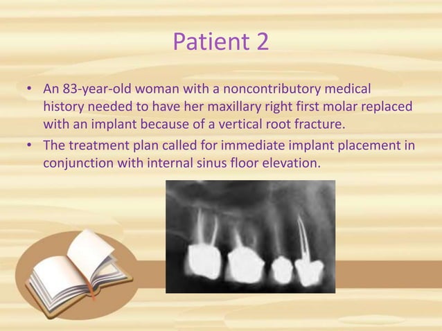 Journal Club On Pre-extractive Interradicular Implant Bed Preparation ...