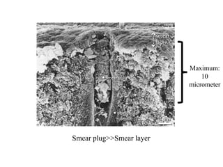 David H Pashley: Clinical considerations of microleakage | PPTX