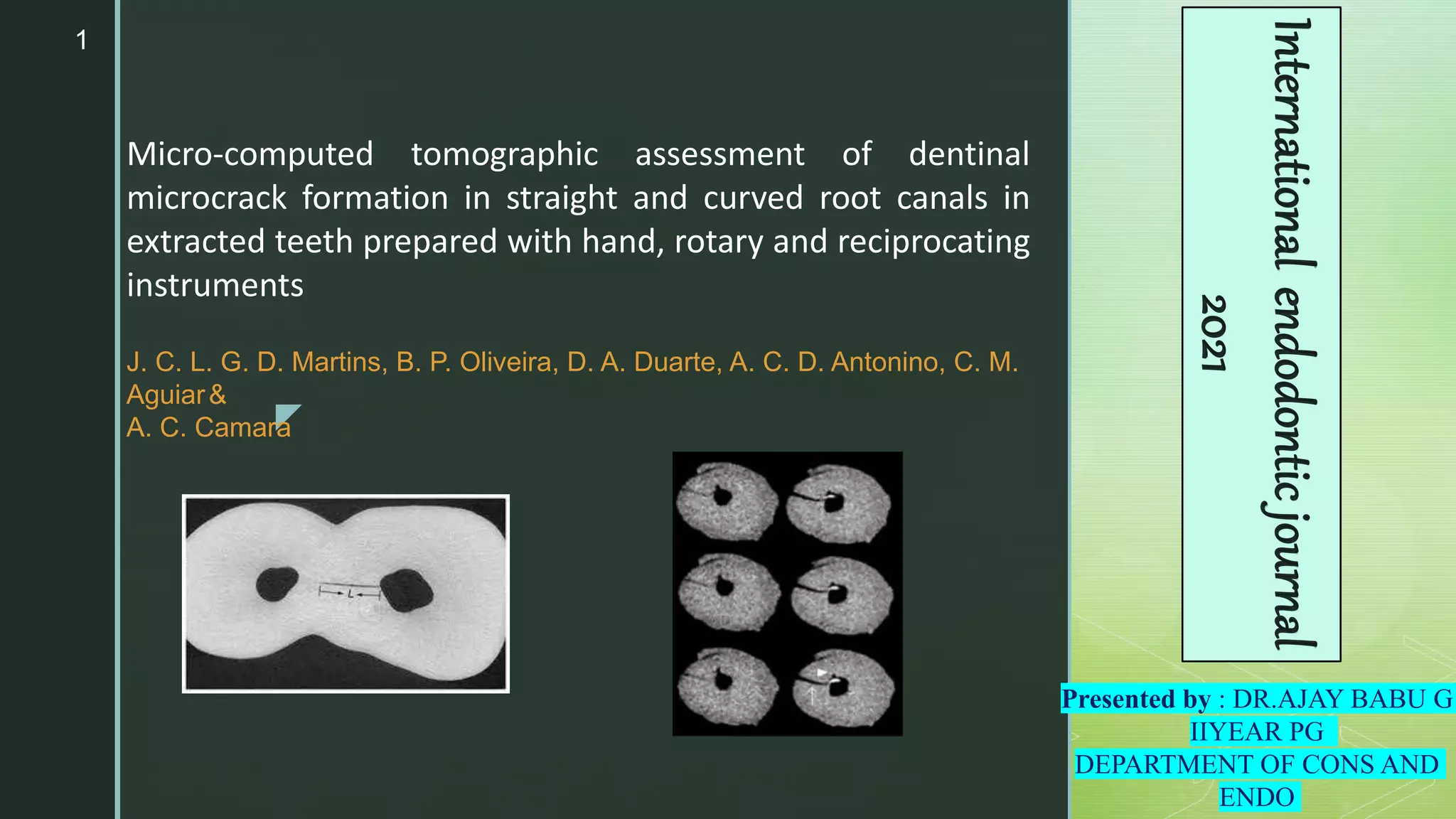 Micro-CT assessment of dentinal microcrack formation in straight and ...