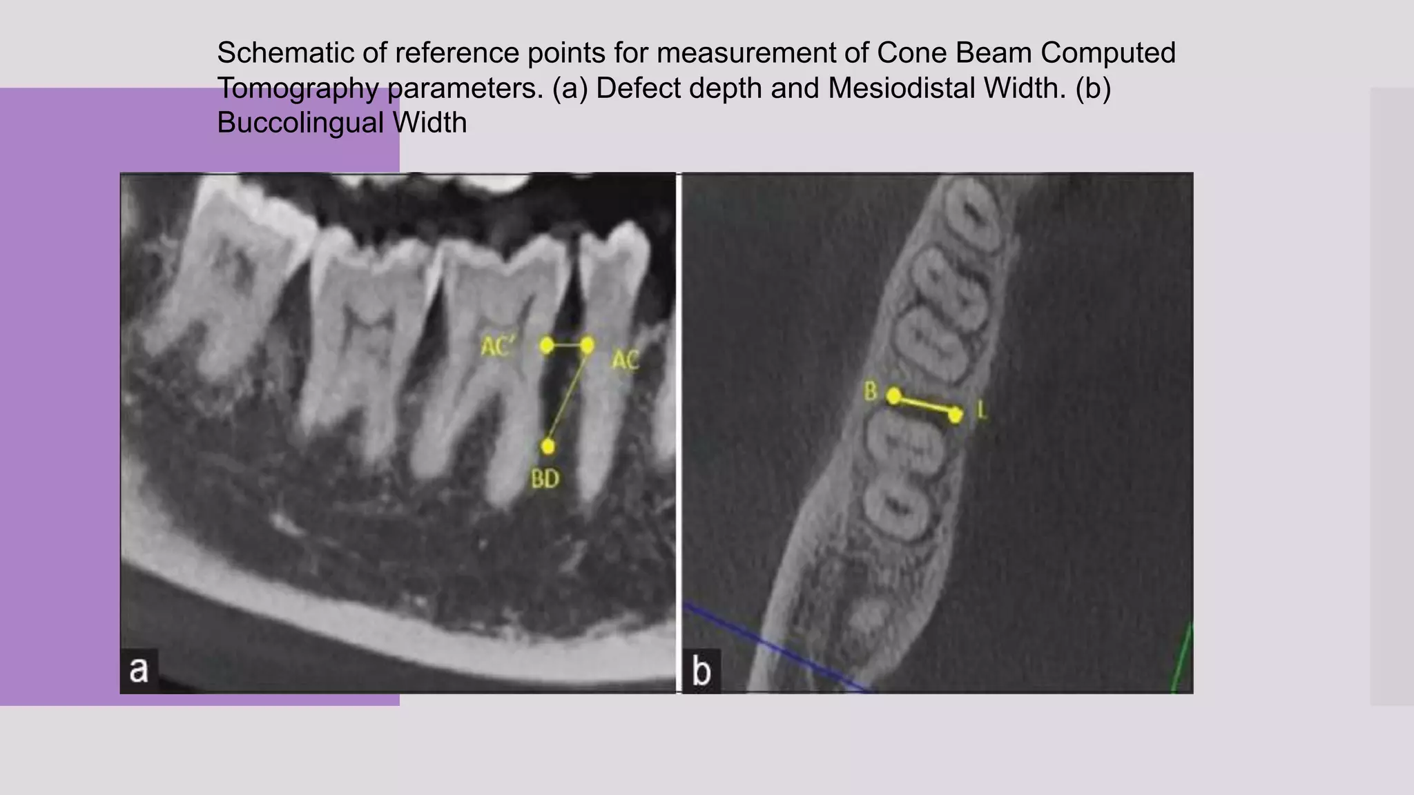 comparison between sticky bone and concentrated growth factor | PPT