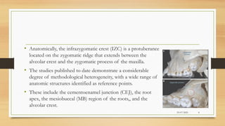 Optimal sites for mini-implant insertion into the infrazygomatic crest ...