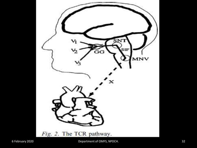 Journal Club New protocol to prevent TMJ reankylosis and potentially ...