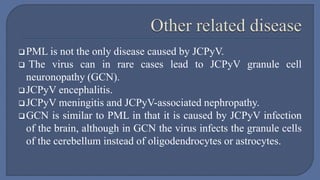 POLYOMAVIRIDEA JC VIRUS - Structure and disease( pathogenesis ...