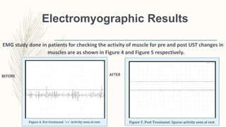 Journal Club Impact of Ultra Sound Therapy on Myofascial Pain ...
