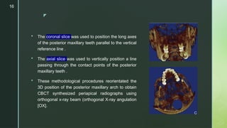 X-ray beam angulation can compromise 2-dimensional diagnosis of ...