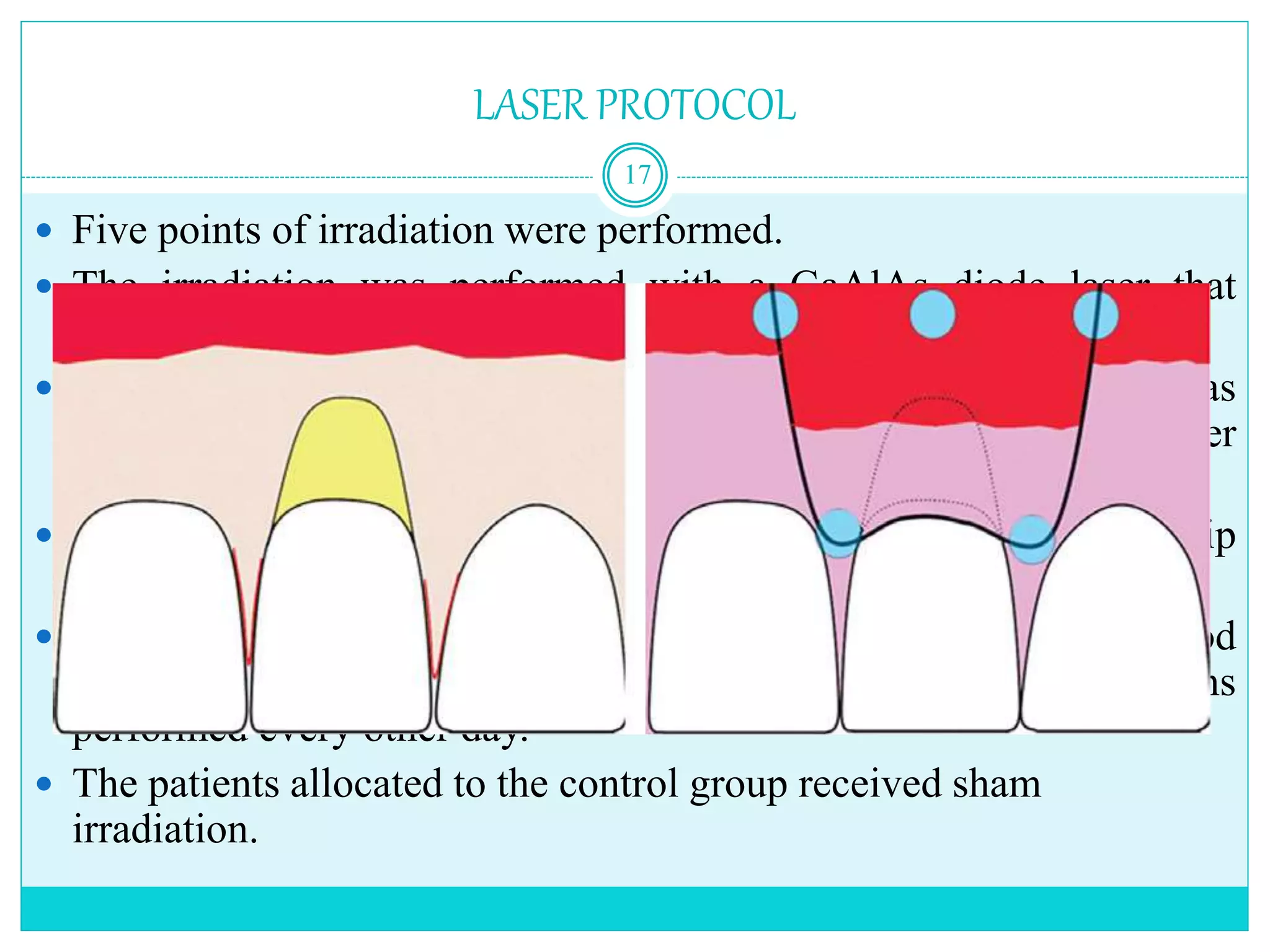 Journal club on Connective tissue graft associated or not with low ...