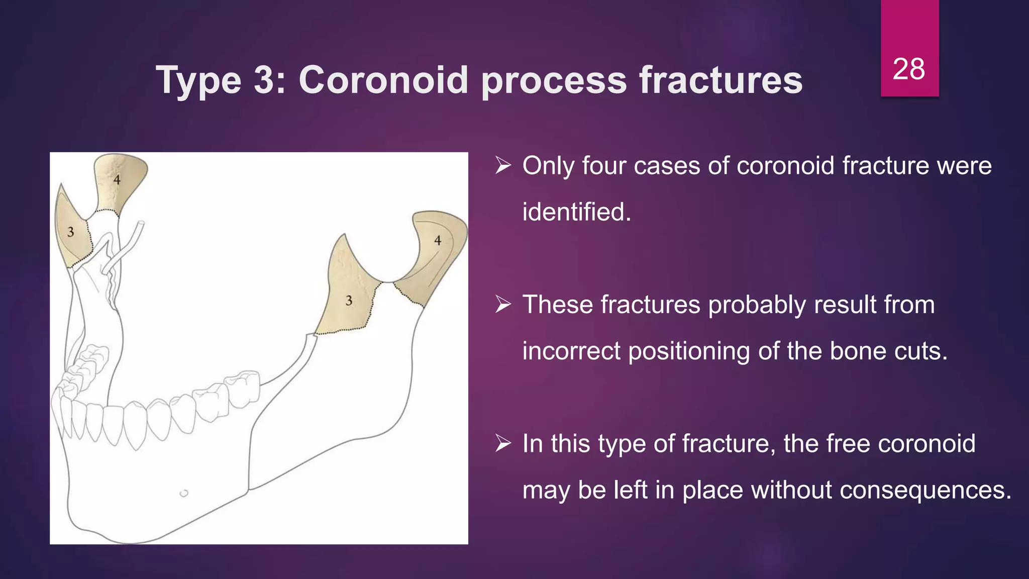 Journal Club Bad splits in bilateral sagittal split osteotomy ...