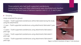 Journal club presentation on tooth supported overdentures | PPTX