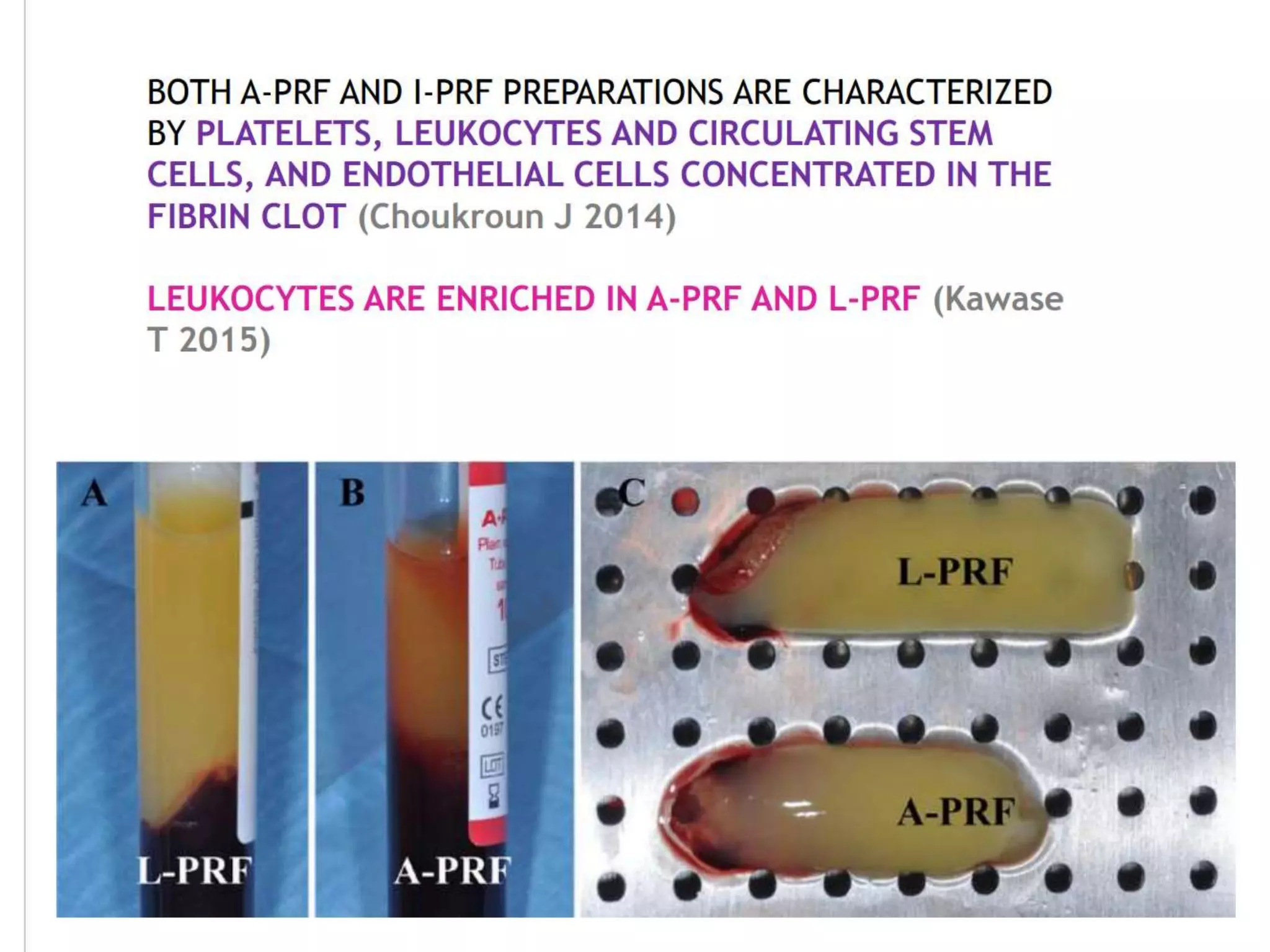 Introduction to Platelet Rich Fibrin (PRF) and its uses in Dentistry | PPTX