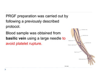 Introduction to Platelet Rich Fibrin (PRF) and its uses in Dentistry | PPTX