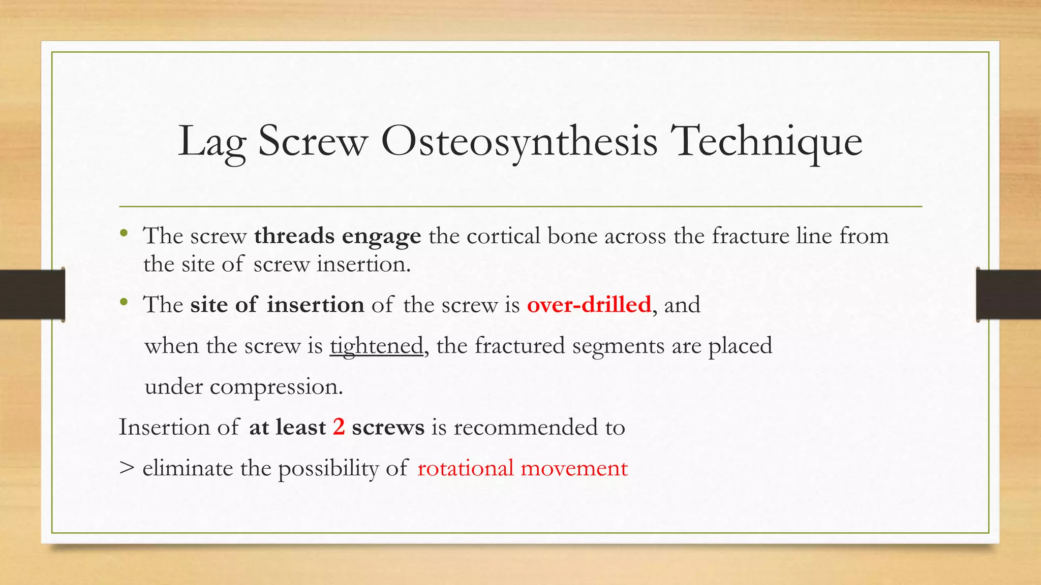 Concepts of Rigid Fixation in Facial Fractures | PPT