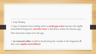 Concepts of Rigid Fixation in Facial Fractures | PPT