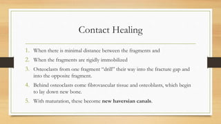 Concepts of Rigid Fixation in Facial Fractures | PPT