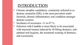 PHOTODYNAMIC THEREPY FOR DENTURE STOMATITIS | PPTX